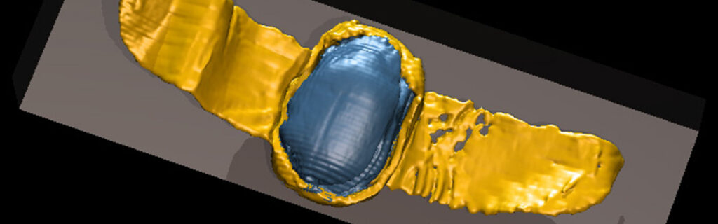 Winged Scarab in an Egyptian Mummy